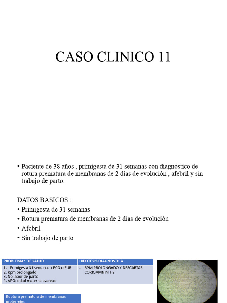 Caso Clínico N°11 | PDF