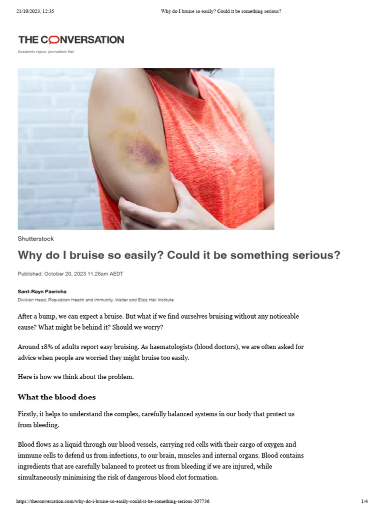 Why Do I Bruise So Easily - Could It Be Something Serious | PDF