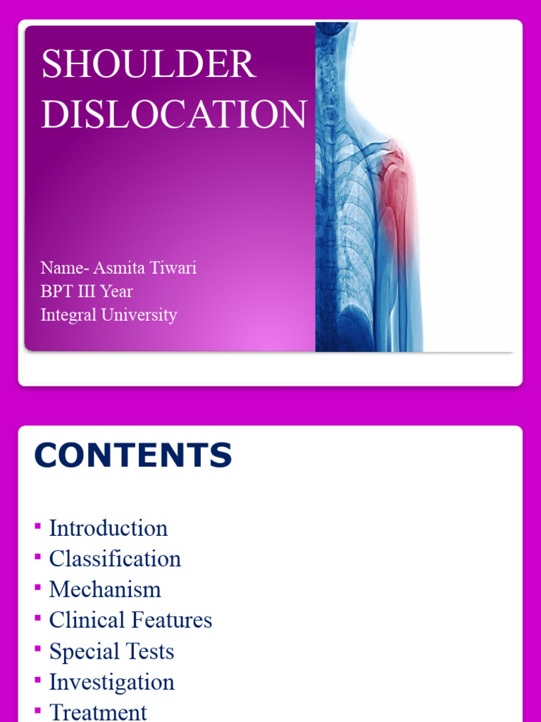 Shoulder Dislocation | PDF | Shoulder | Limbs (Anatomy)