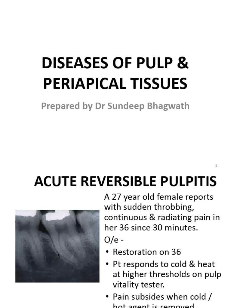 5-Diseases of Pulp & Periapical Tissues OSPE | PDF