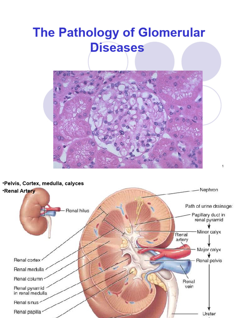 The Pathology of Glomerular Diseases | PDF