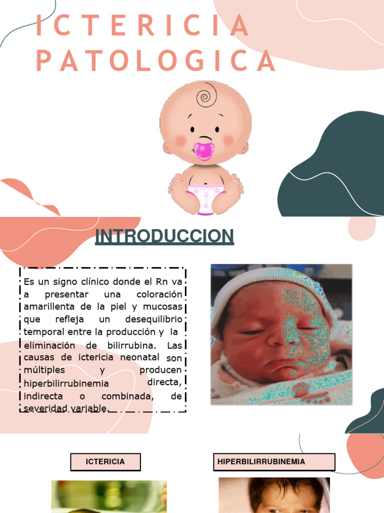 Ictericia Patológica Neonatal: Causas y Manejo | PDF | Ciencia y ...