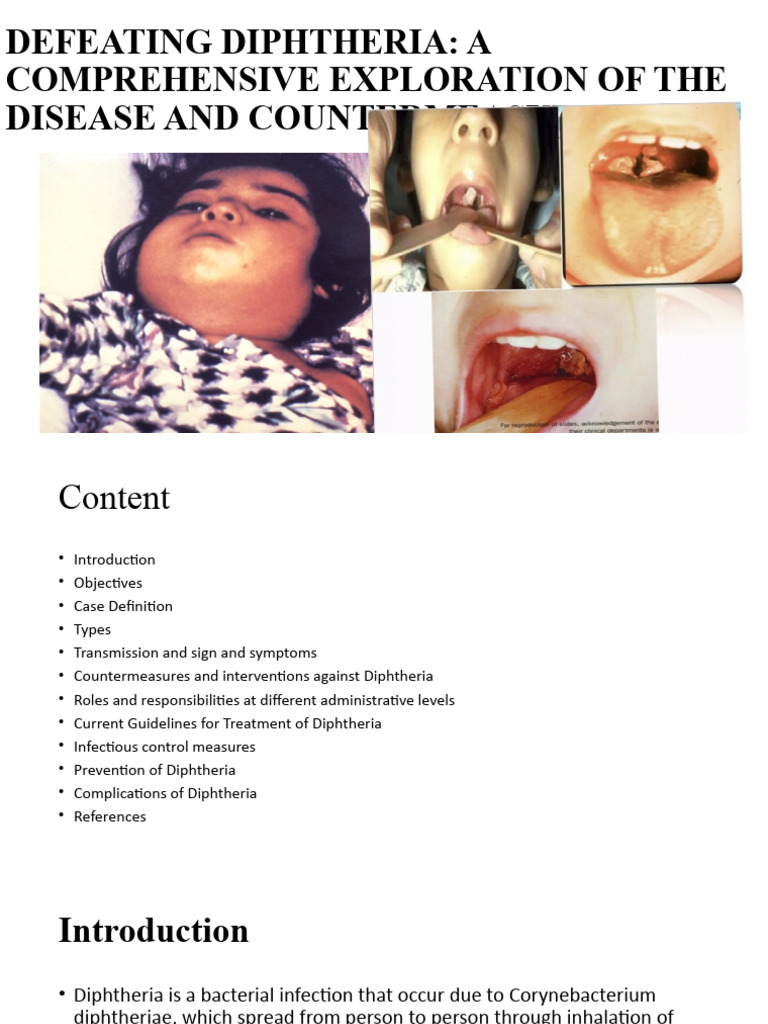 Diphtheria: Disease Overview & Management | PDF | Wellness | Science ...