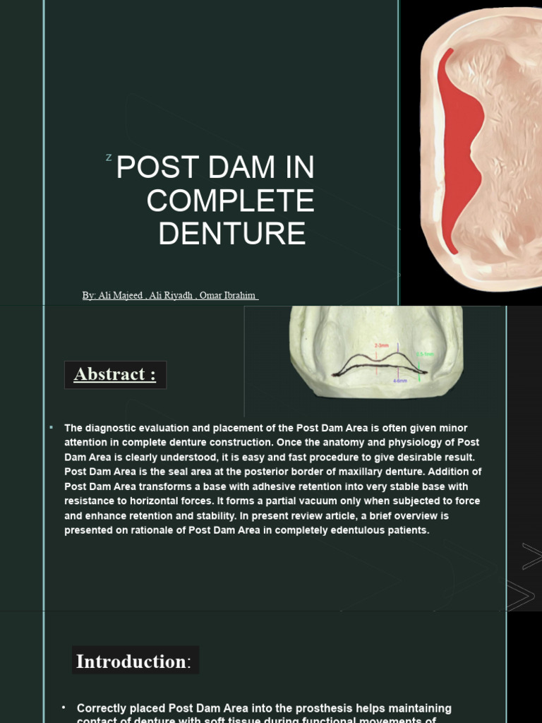 سمينار Post Dam | PDF