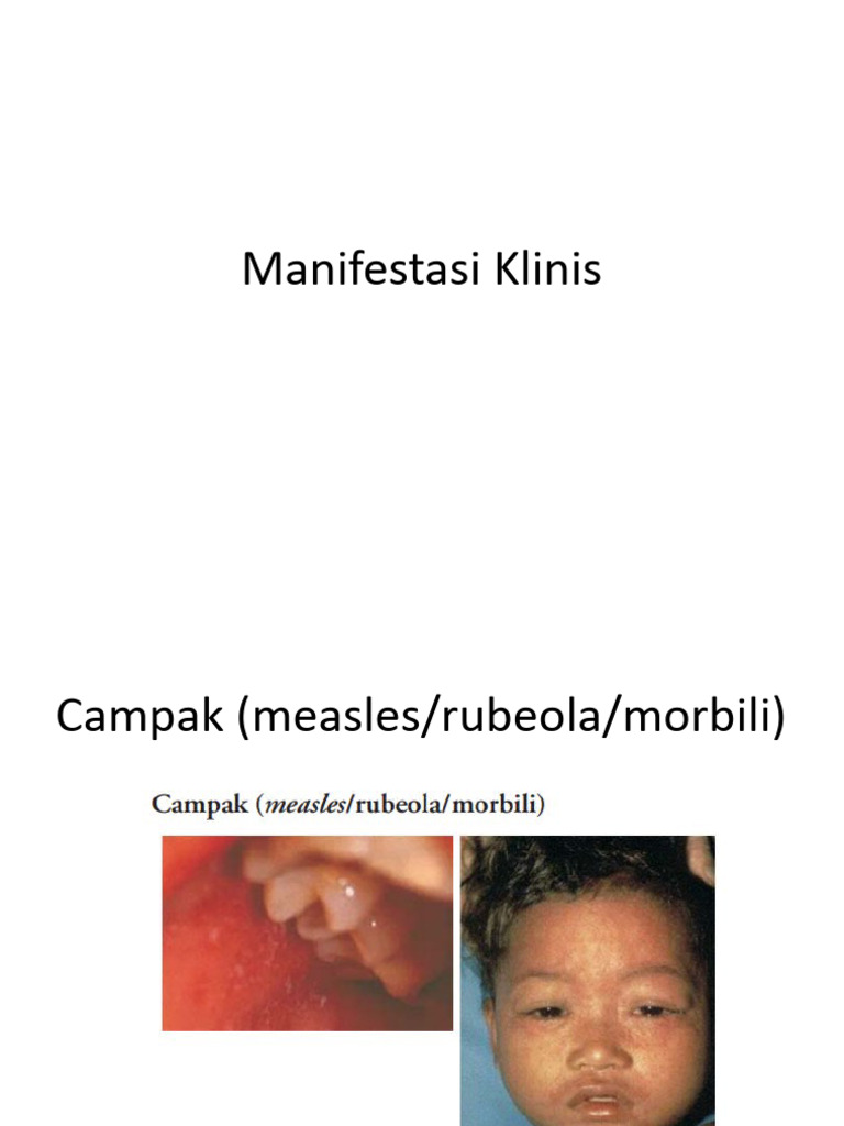 Manifestasi Klinis SK3 | PDF