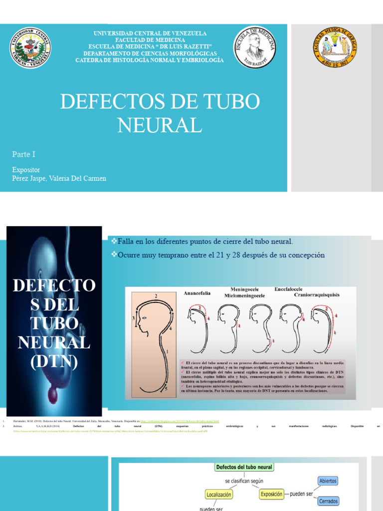 Defectos de Tubo Neural | PDF