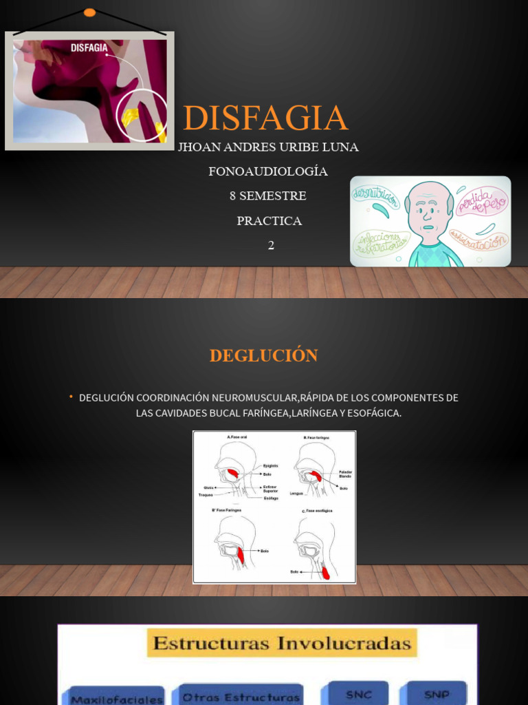 Disfagia | PDF