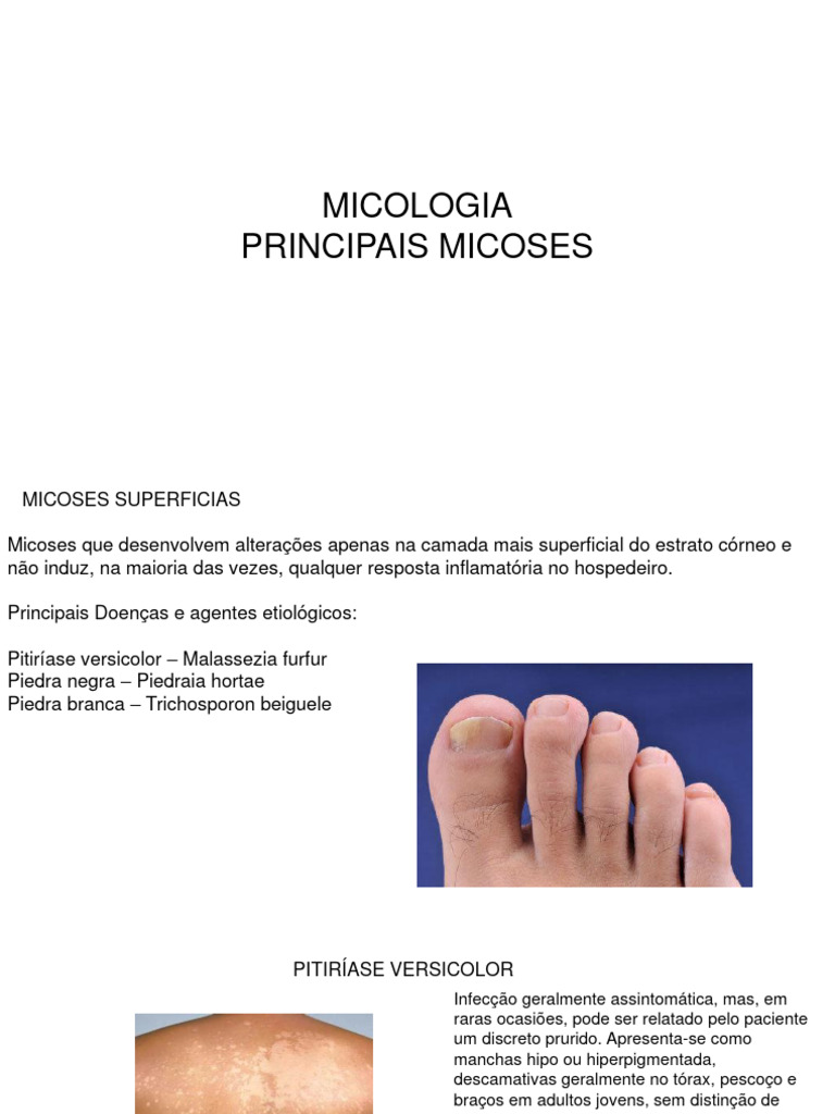 Micologia b2 Principais Micoses | PDF