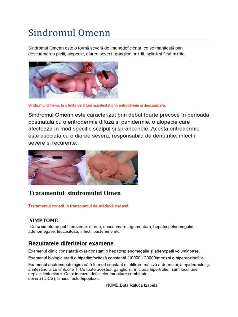 Sindromul Omenn | PDF