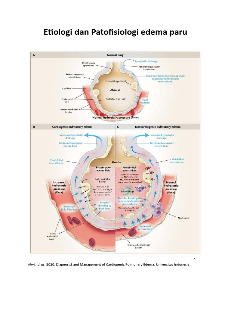Patofisiologi Edema Paru | PDF