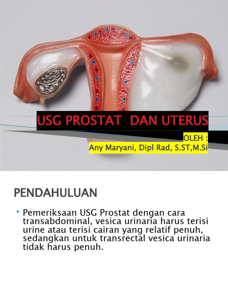 Usg Prostat & Uterus | PDF