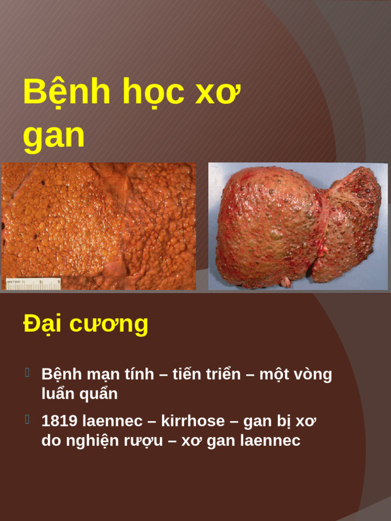 Bai-Giang Benh-Hoc-Xo-Gan | PDF