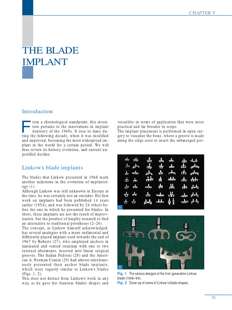 The Blade Implant - Book | PDF