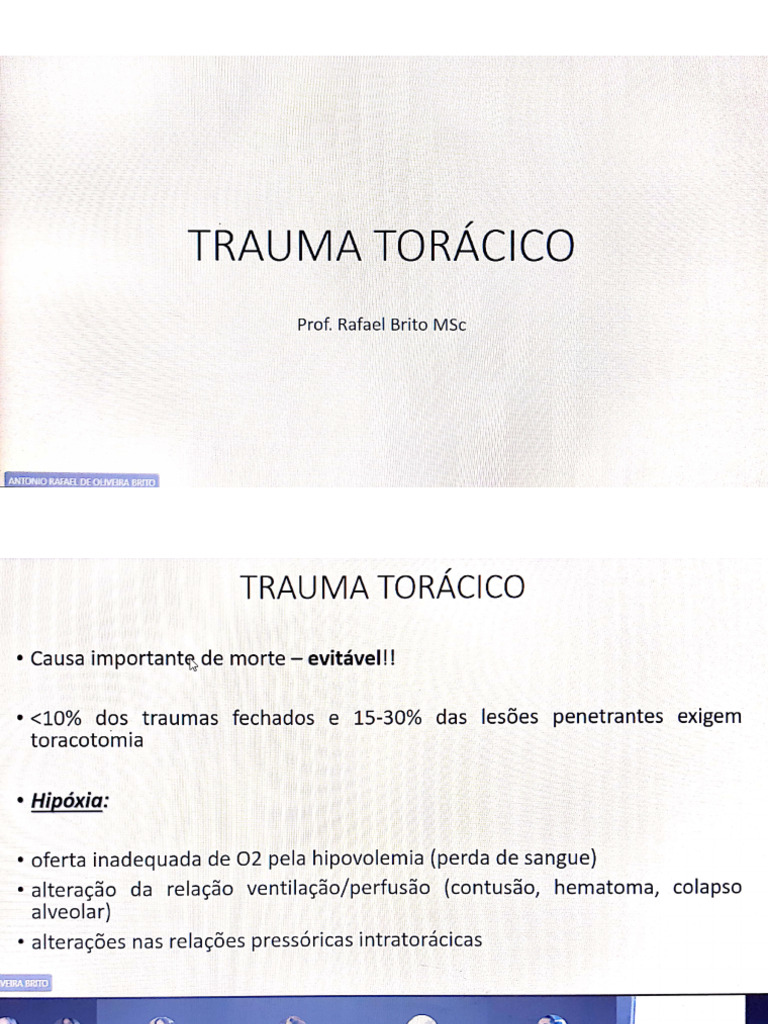 Aula 01 - Trauma Torácico - DrRafael | PDF