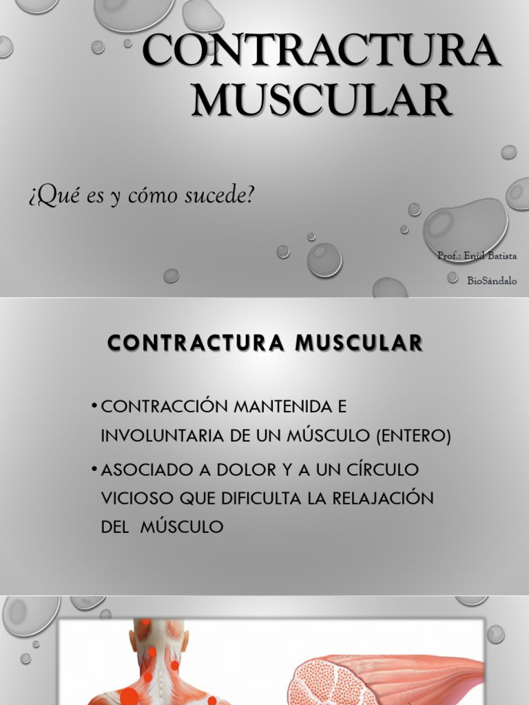 Causas y Tratamientos de Contractura Muscular | PDF