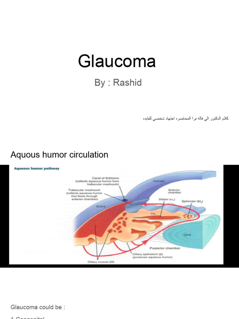 Glaucoma Notes Pdf Glaucoma Human Eye