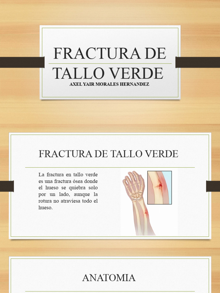 Fractura de Tallo Verde | PDF