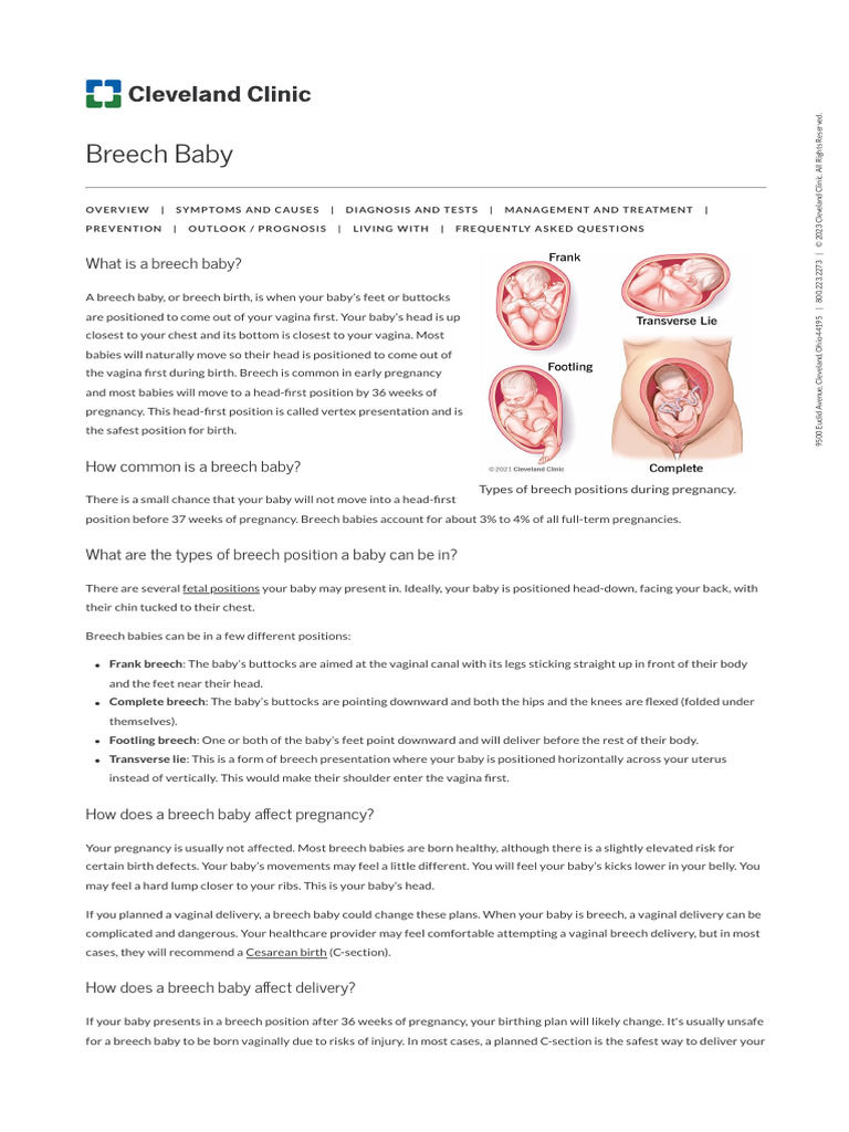 Breech Baby - Causes, Complications, Turning & Delivery | PDF ...