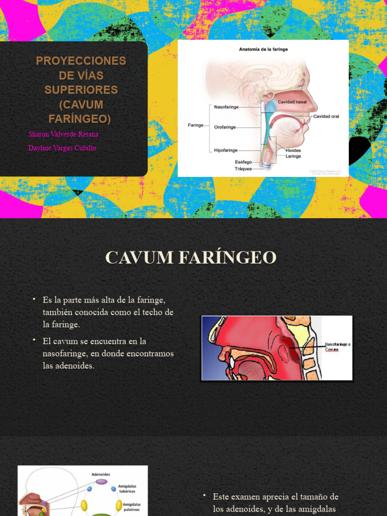 Presentación Cavum | PDF