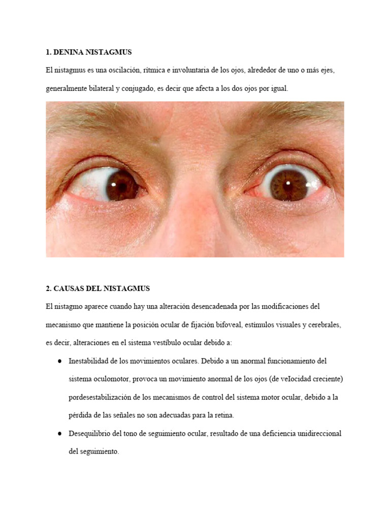 Guía Completa del Nistagmus | PDF | Medicina CLINICA | Sistema nervioso