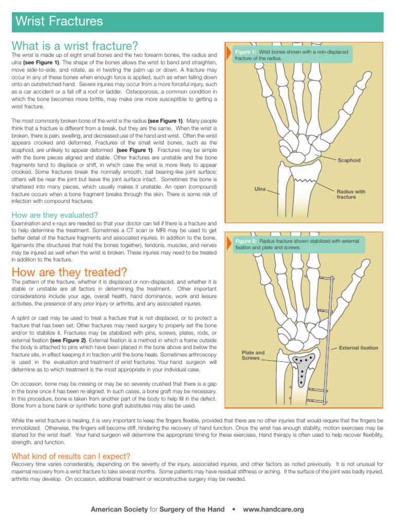 Wrist Fracture | PDF