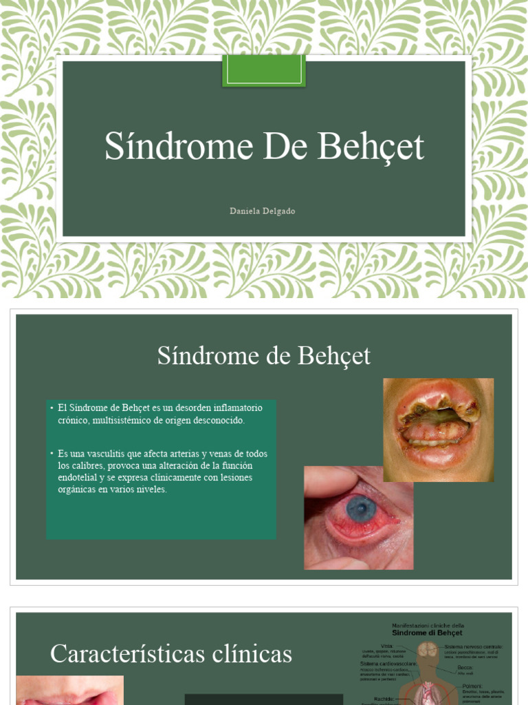 Síndrome de Behçet | PDF