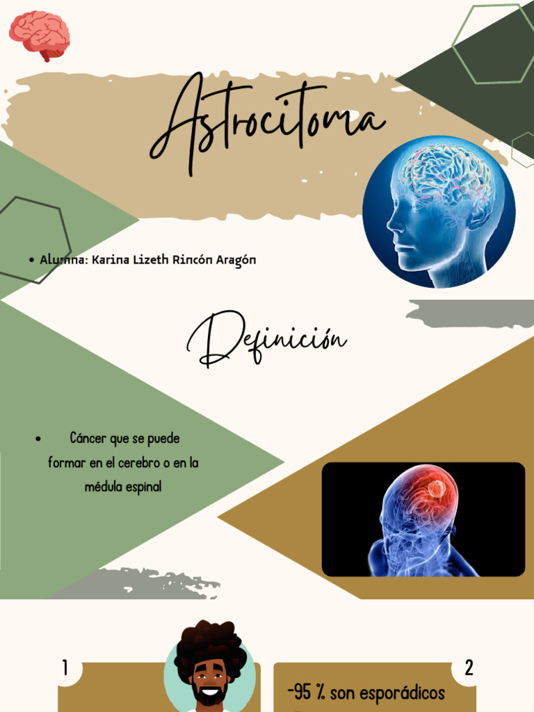 Astrocitoma | PDF