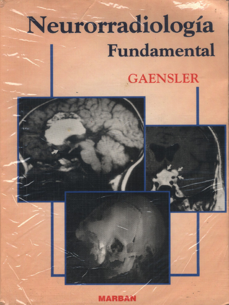 Neurorradiología Fundamental (Gaensler) | PDF