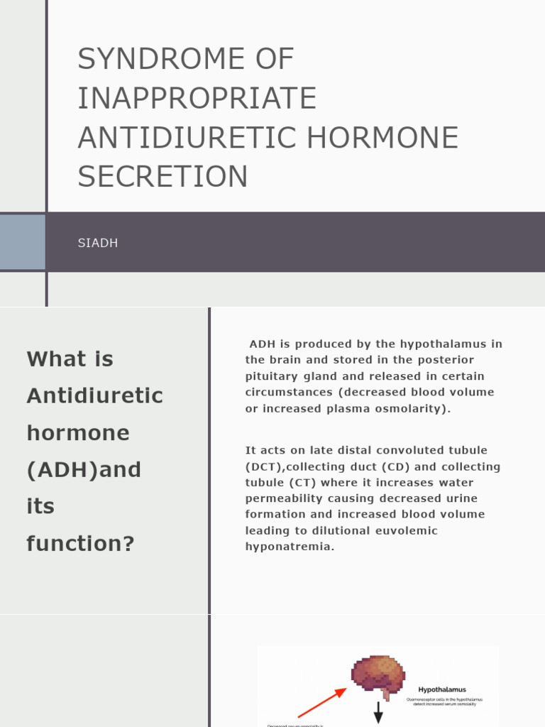Presentation On SIADH | PDF | Medical Specialties | Clinical Medicine
