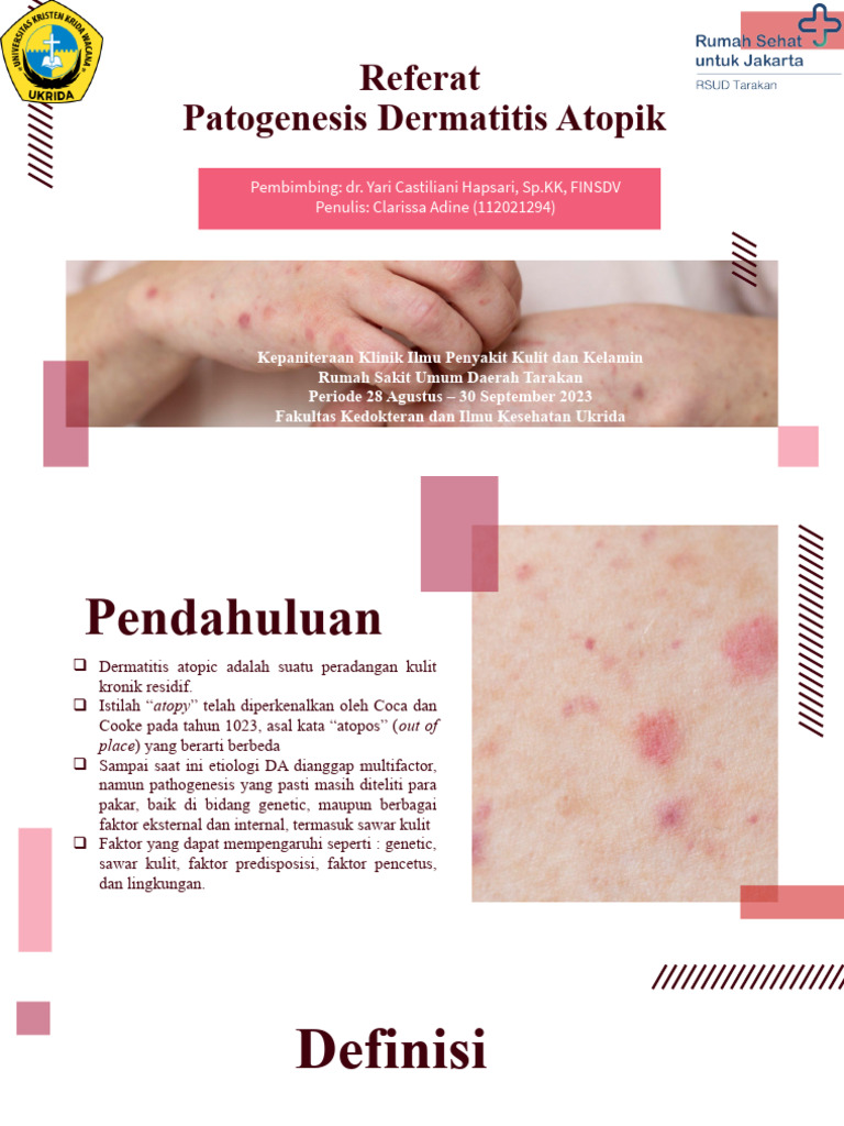 Referat Clarissa Adine - Atopic Dermatitis | PDF