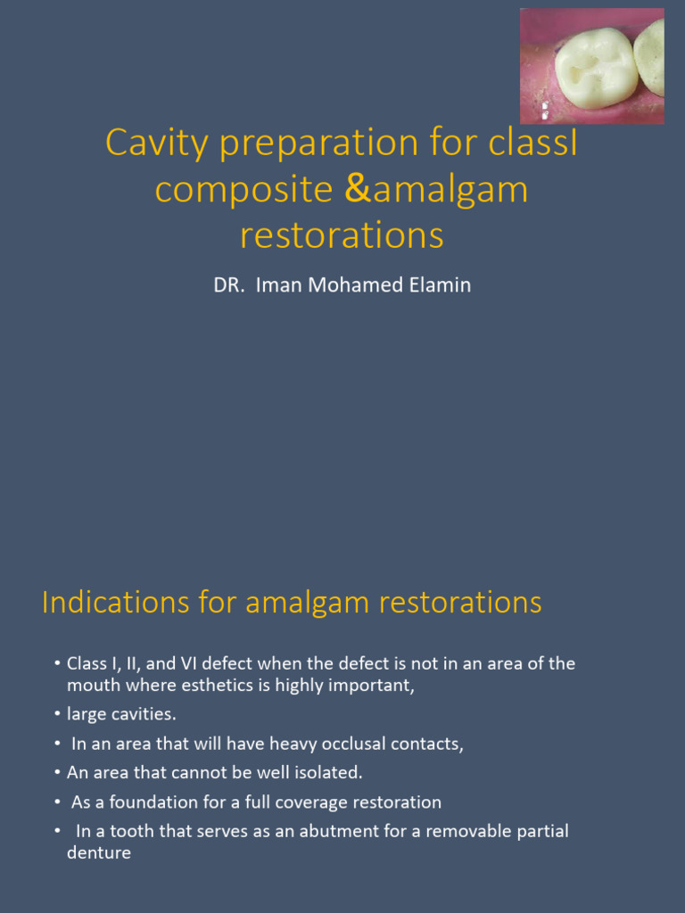 Cavity Prepration For Class 1 Composite and Amalgam Restorations | PDF