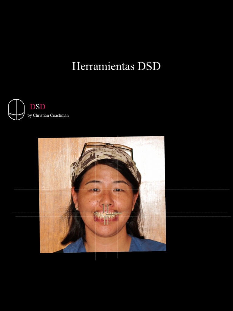 EJEMPLO DSD Pamela 2 | PDF