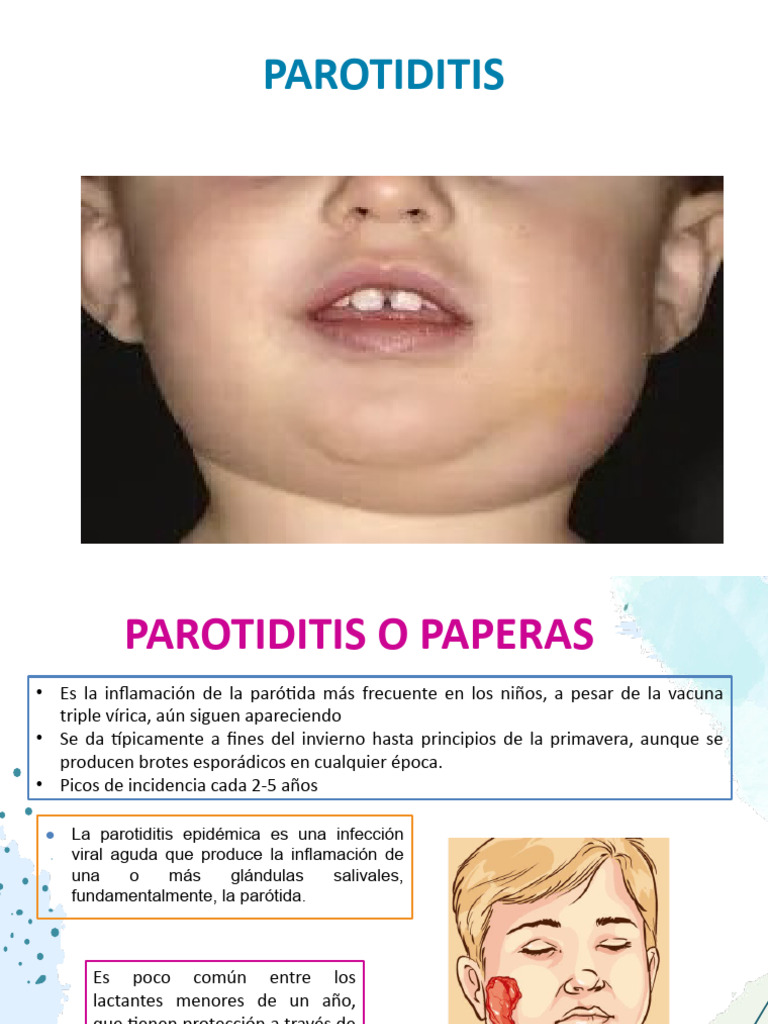 Parotiditis Pediatría | PDF