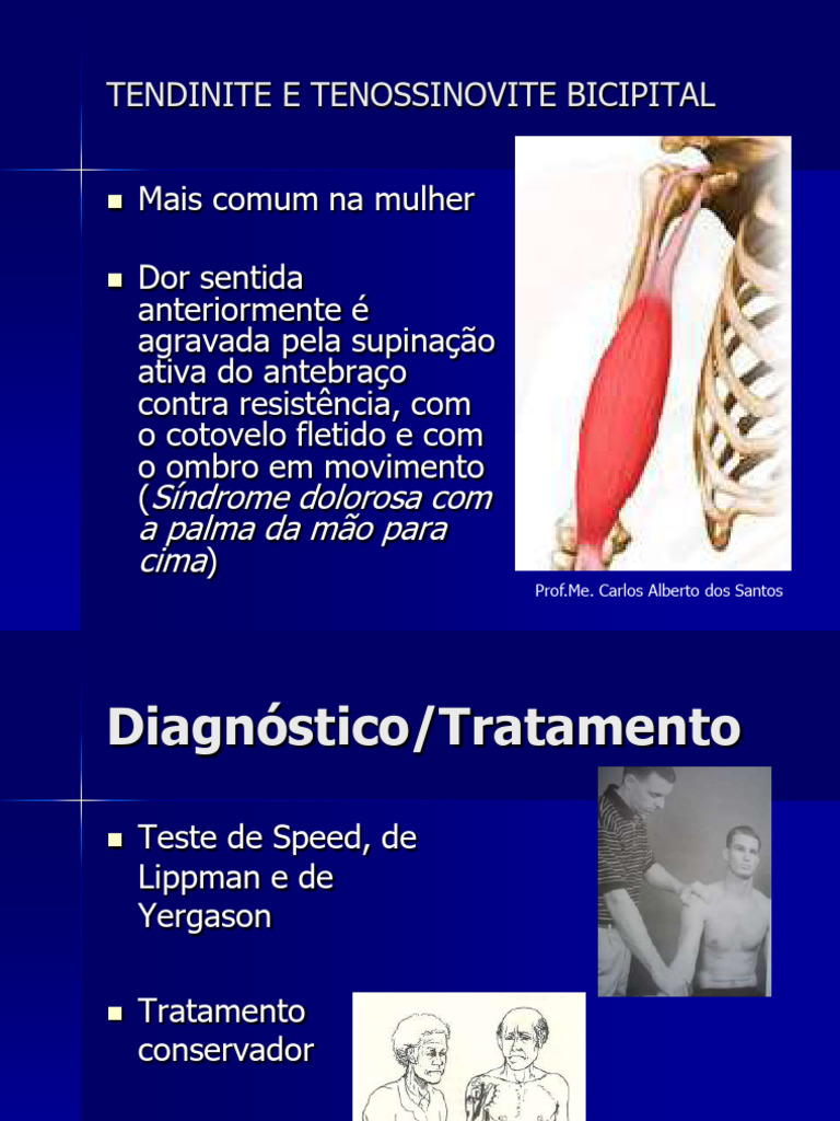 Tendinite e Tenossinovite Bicipital | PDF