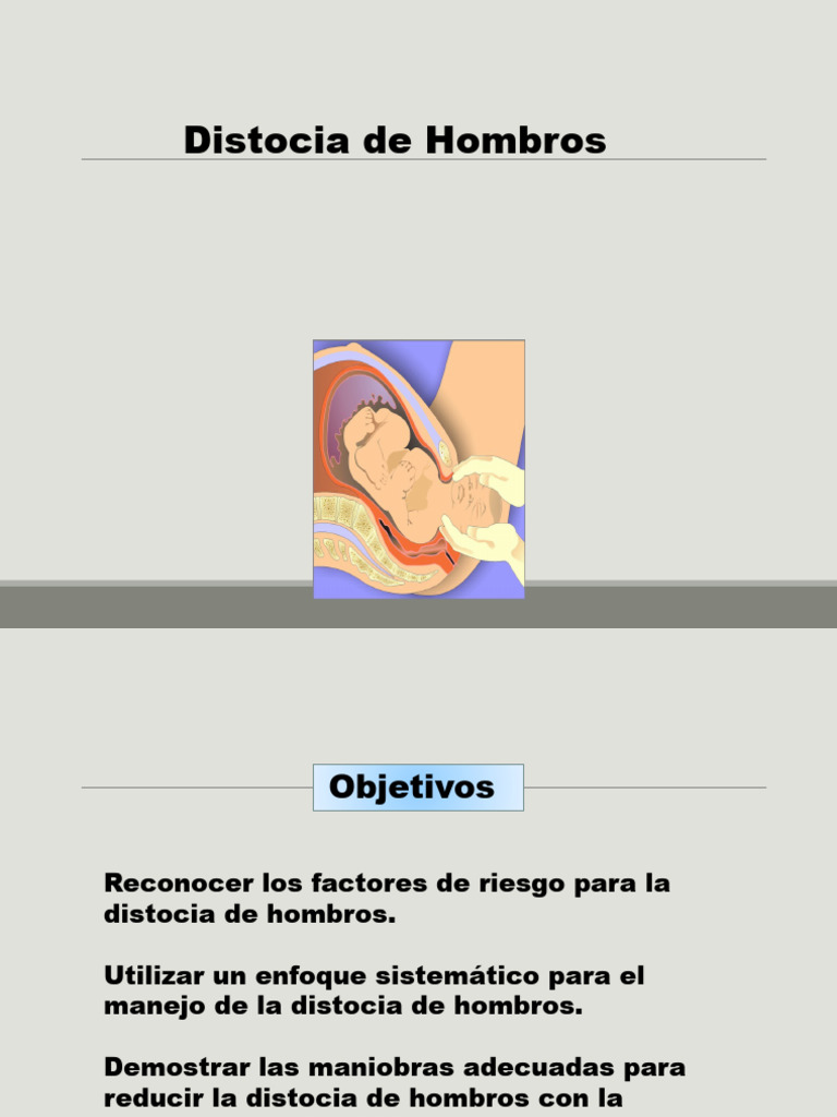 Distocia de Hombros | PDF | Pelvis | Parto