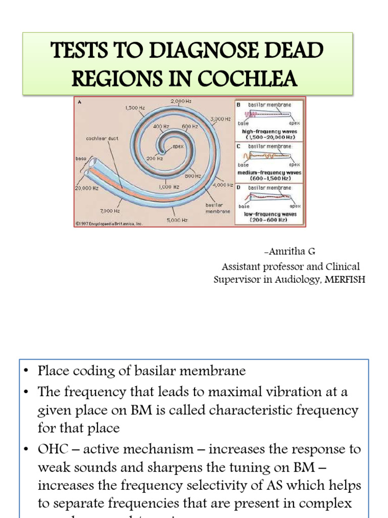 Diagnosing Cochlear Dead Regions | PDF | Hearing Loss | Hearing