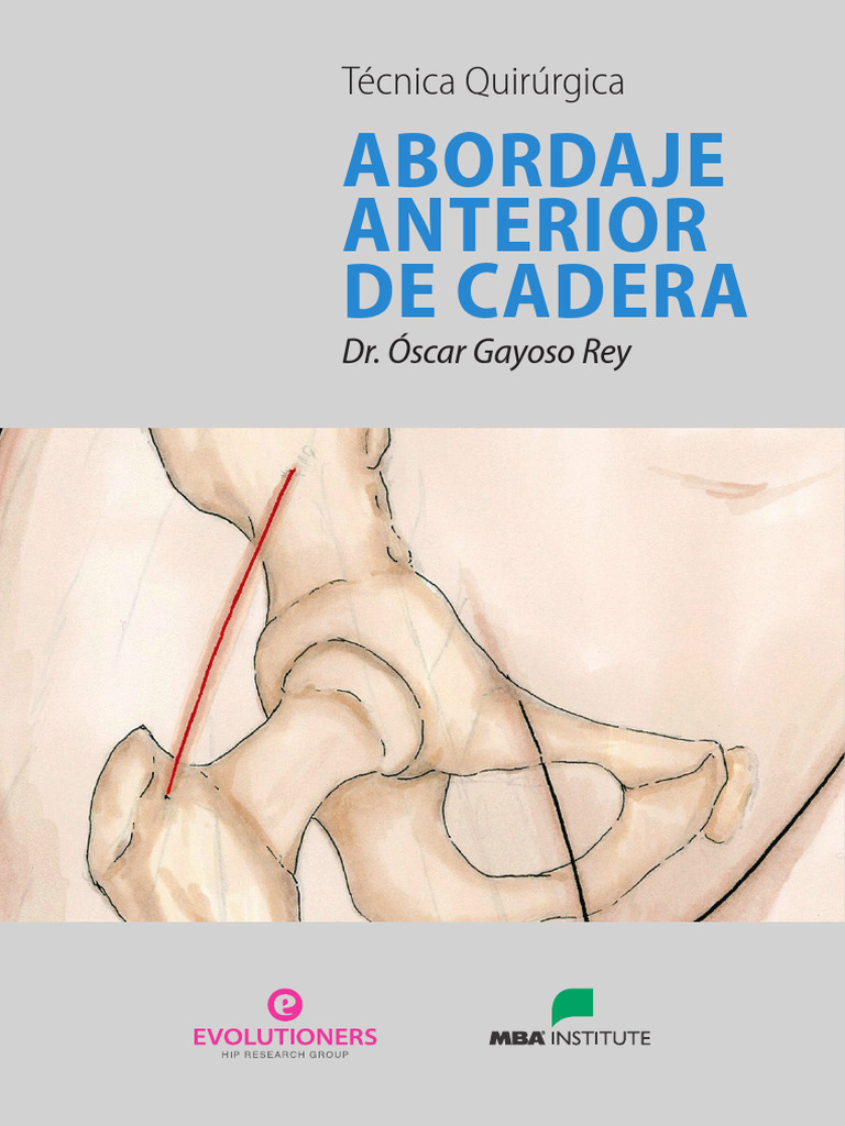 Abordaje anterior de cadera | PDF | Cirugía | Sistema musculoesquelético