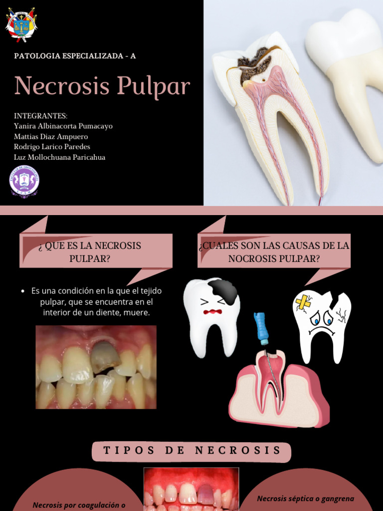 ¿Que Es La Necrosis Pulpar | PDF