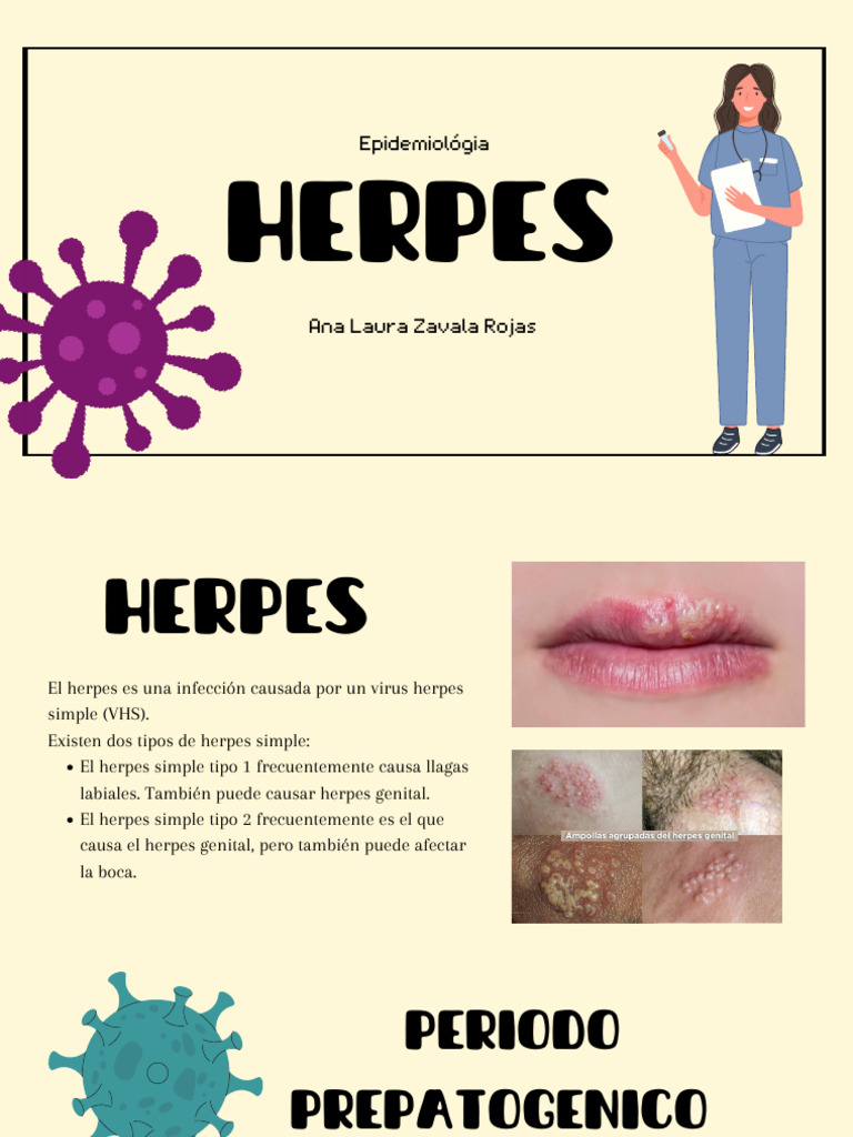 HERPES | PDF | Herpes Simple | Inmunología