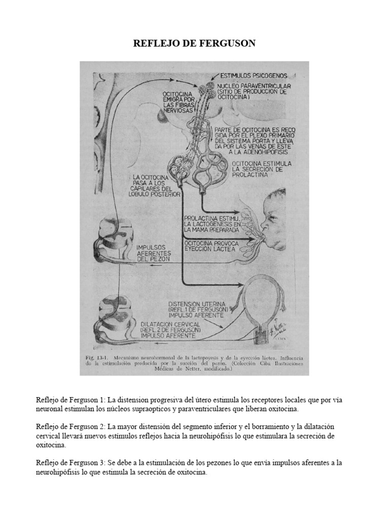 Reflejo de Ferguson | PDF