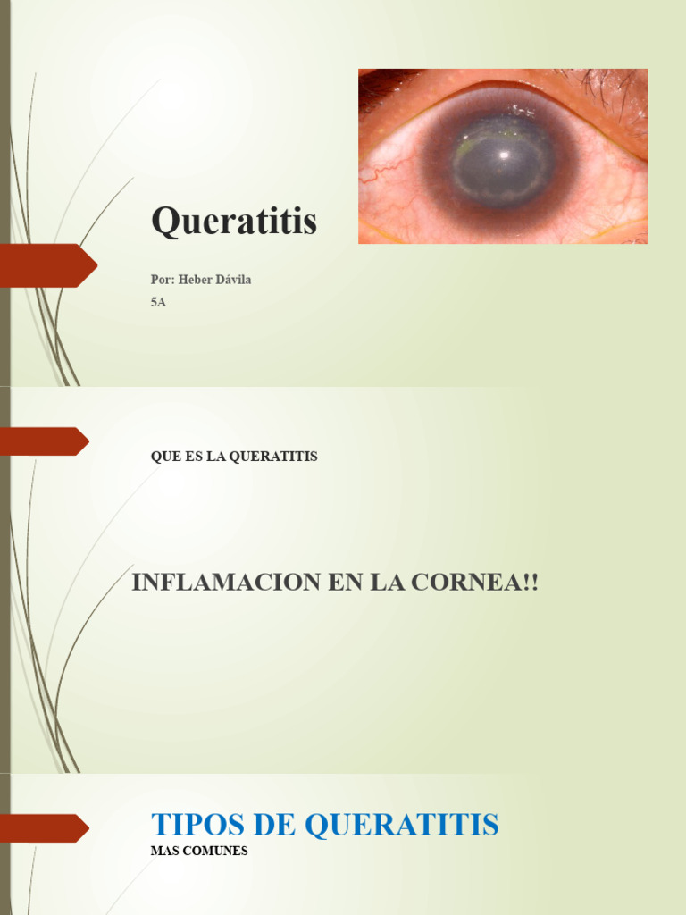 Tipos de Queratitis y sus Causas | PDF | Hogar, jardinería y bricolaje ...