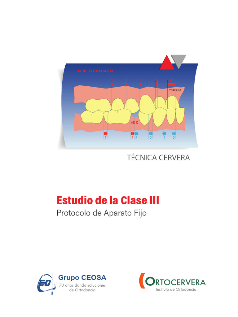 Protocolo de Aparato Fijo de Clase III Extracciones 10 Enero 2023 | PDF | Odontología | Ortodoncia