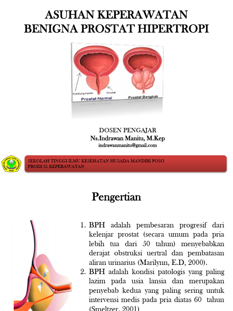 Askep Begina Prostat | PDF