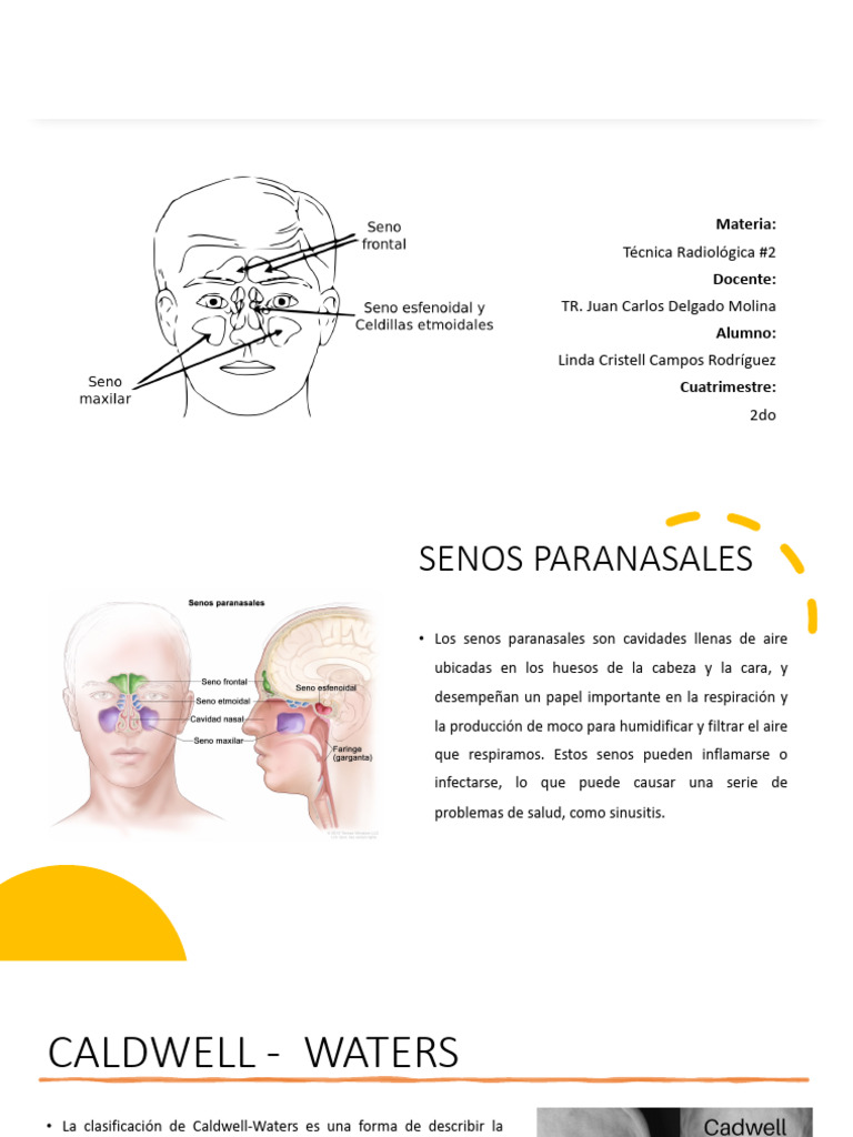 Técnicas Radiológicas de Senos Paranasales | PDF | Medicina CLINICA ...