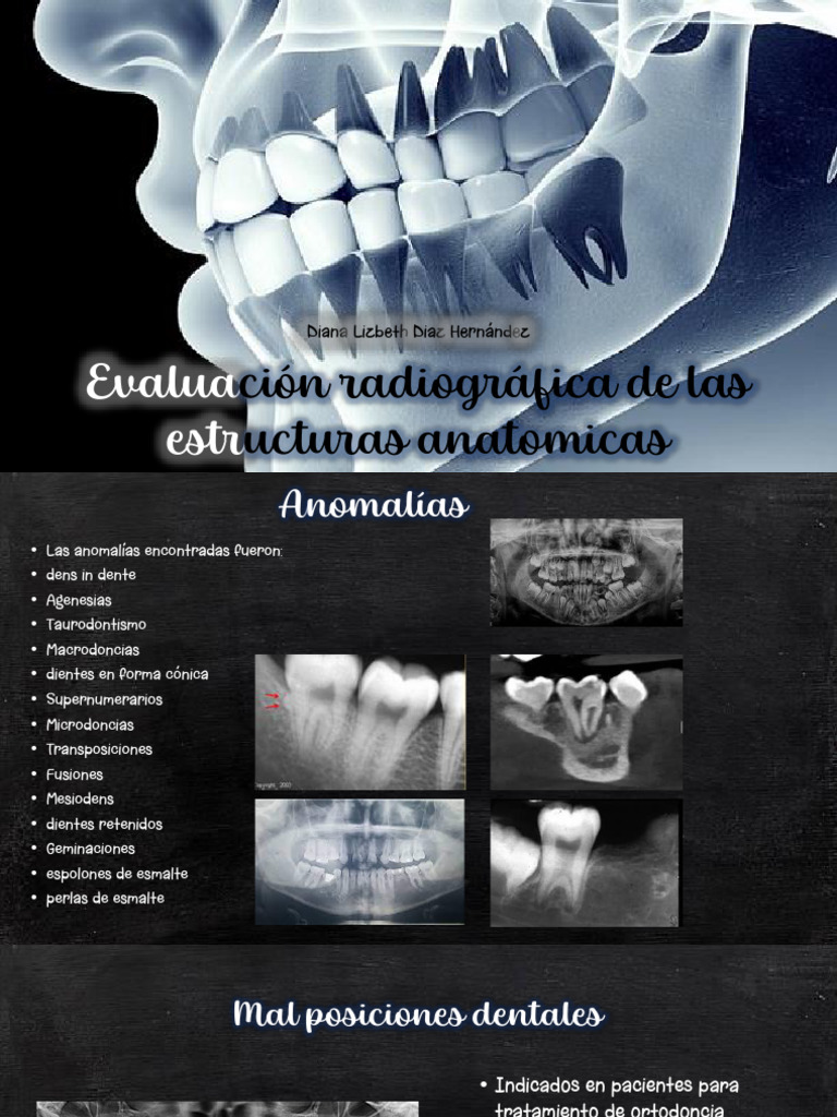 Evaluación radiográfica de las estructuras anatomicas | PDF | Diente | Medicina CLINICA