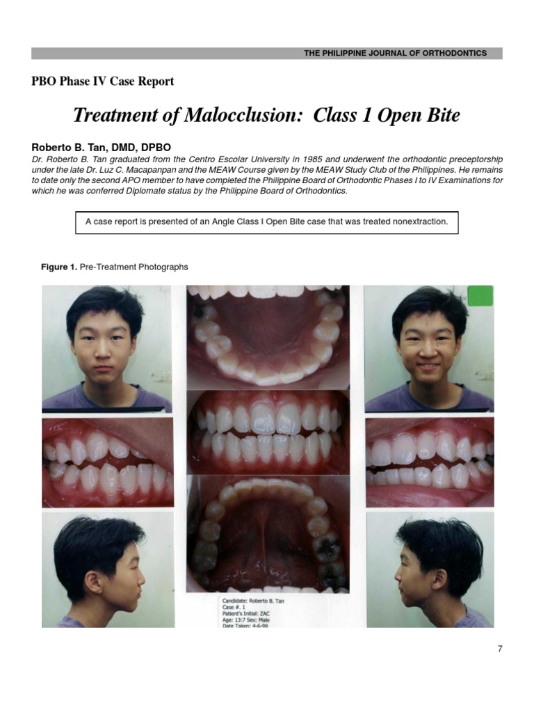 Open Bite Case | PDF | Tooth | Physiognomy