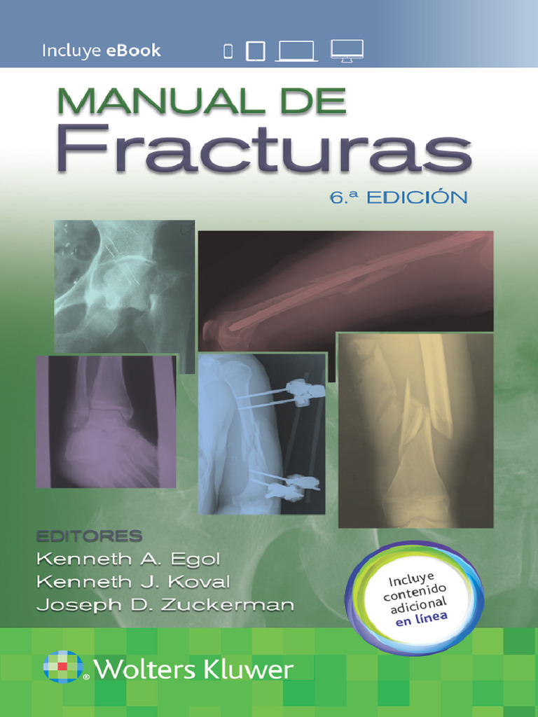 Manual de Fracturas 6e | Descargar gratis PDF | Rodilla | Lesión
