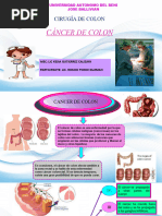 Suboclusion Intestinal | PDF | Enfermedades digestivas | Gastroenterología