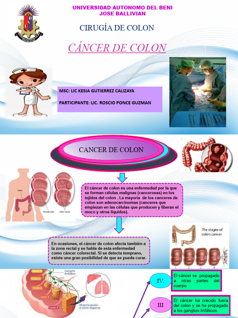 Cancer de Colon | PDF | Cáncer colonrectal | Cáncer