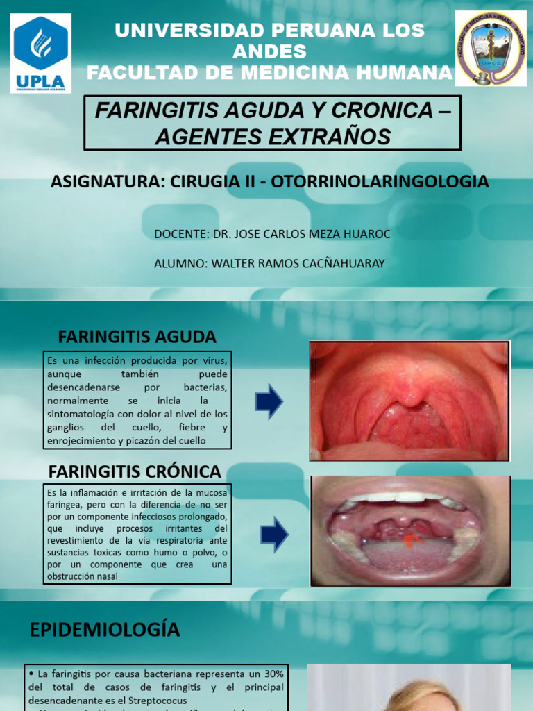 Faringitis Aguda y Cronica | PDF